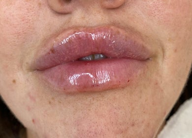 Charlotte Lucy Aesthetics - HOUSE OF GOLD 2A/3A Weddell Wynd - Bilston ...